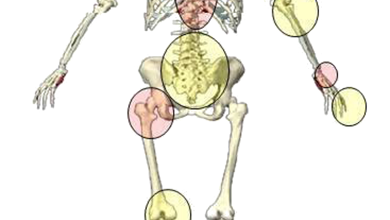 Charlie Weingroff: The Joint-by-Joint Approach to Training - On Target ...