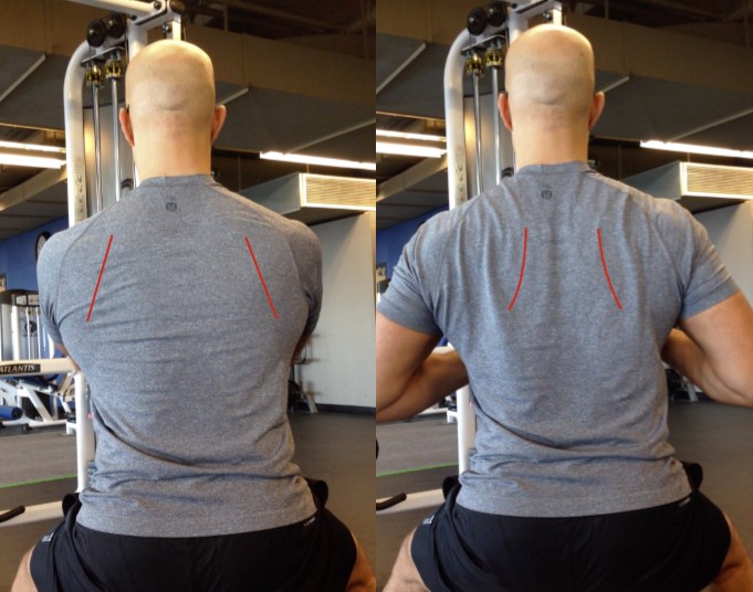 Evan Osar: Forward Shoulder Posture and Scapular Retraction Exercises ...